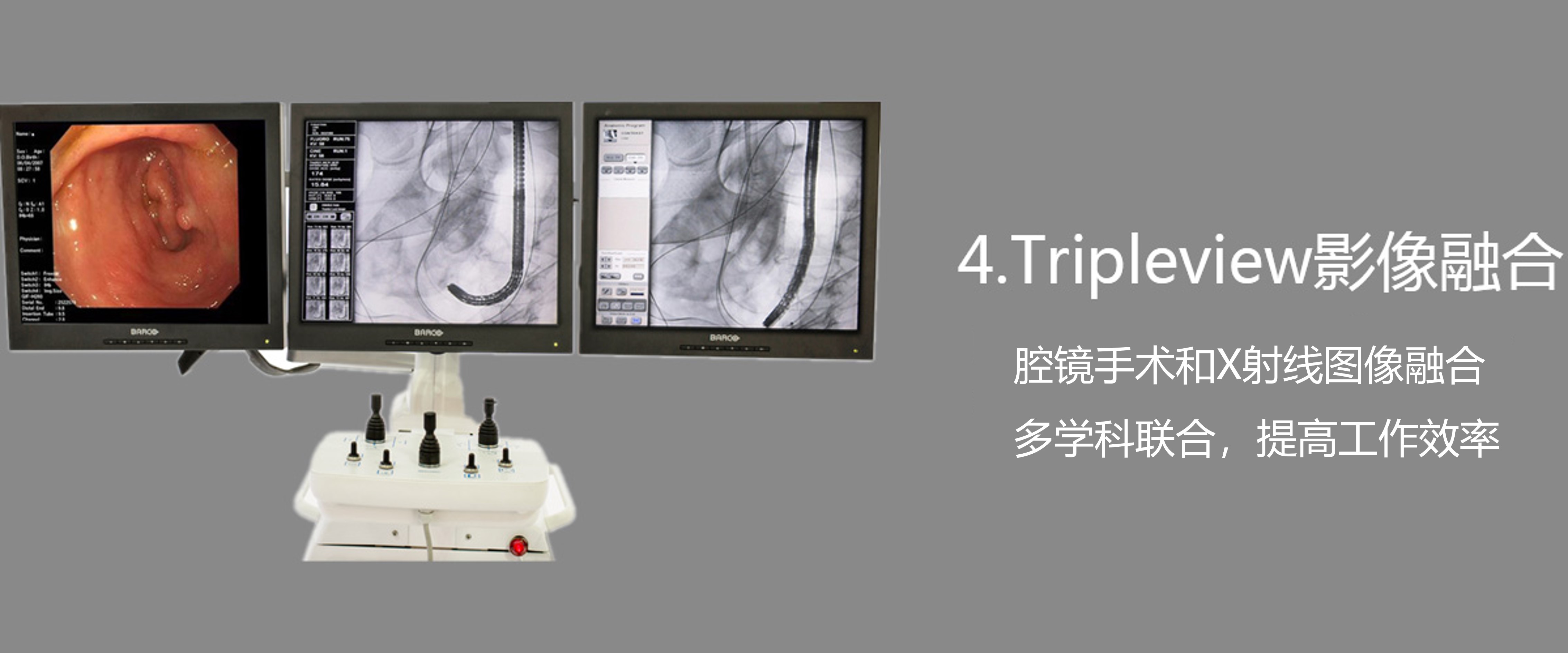 Alien E——可移动的DSA_临床解决方案_产品及临床解决方案_唯迈医疗
